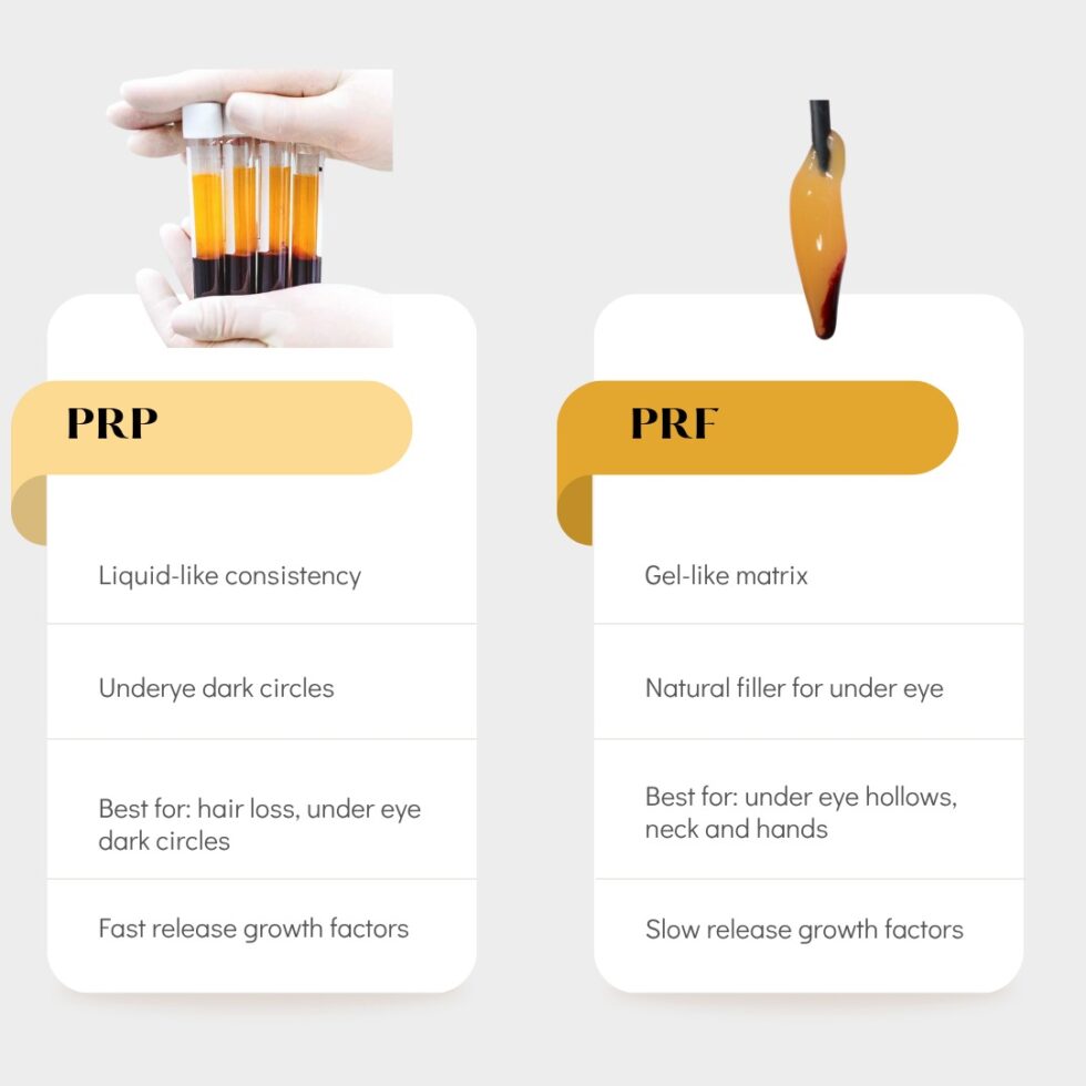 Platelet Rich Fibrin (PRF) - YYC BOTOX